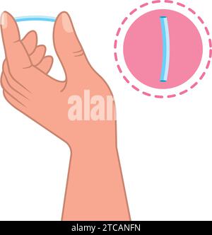 contraceptive implant design Stock Vector Image & Art - Alamy