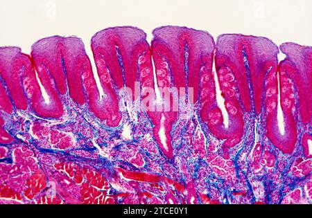 Human tongue cross section with taste buds or gustatory cells. Optical ...