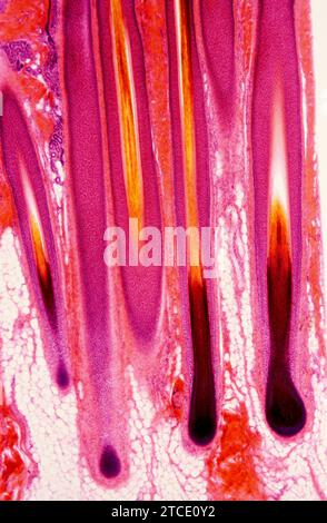Human scalp and hair follicle, light micrograph Stock Photo - Alamy