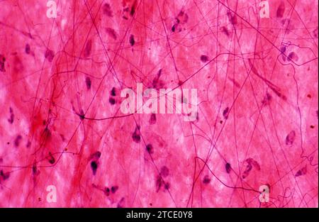 Areolar loose connective tissue, light micrograph. This type of loose ...