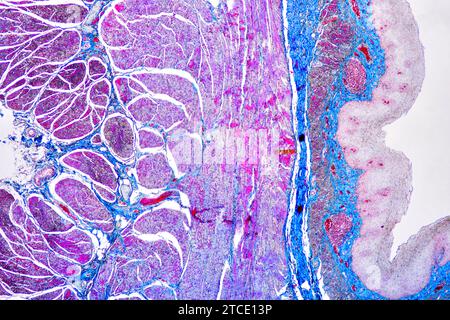 Human esophagus or oesophagus showing squamous epithelium stratified ...