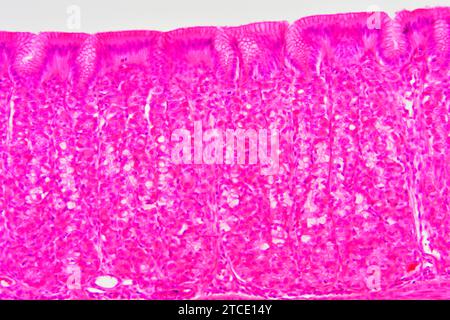 Stomach cross section showing mucosa, submucosa and gastric glands ...