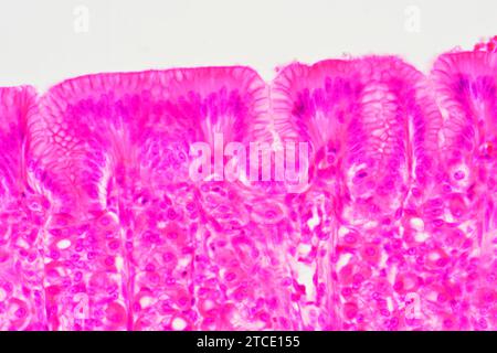 Stomach cross section showing mucosa, submucosa, muscular layer, serosa ...