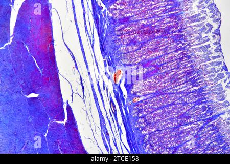 Stomach cross section showing mucosa, submucosa, muscular layer and ...