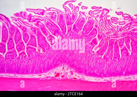 Cross section of intestine with villi. Optical microscopoe ...