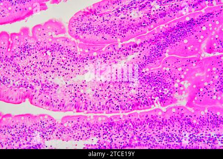 Small intestine cross section showing mucosa, submucosa, lamina propria ...