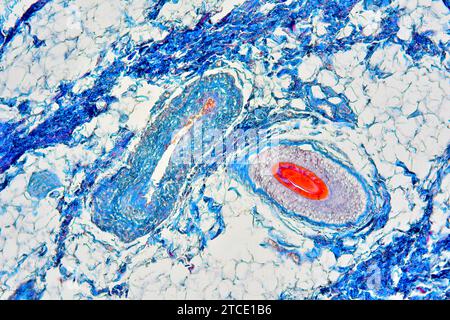 Rectum (large intestine) showing adipose, connective and muscular ...