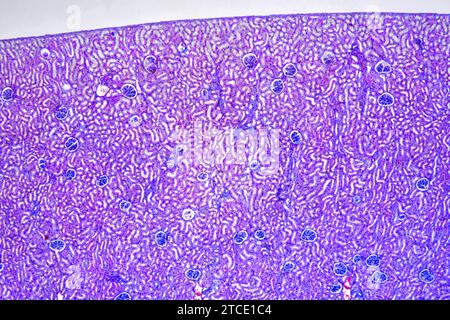 Human kidney section showing renal cortex with glomeruli, Malpighian ...