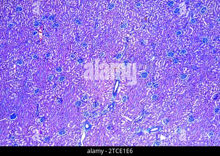 Human kidney section showing renal cortex with glomeruli, Malpighian ...
