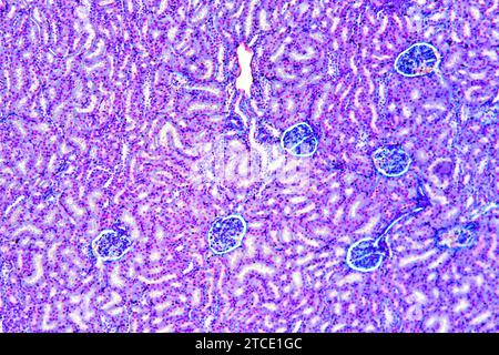 Human kidney (renal cortex section) showing nephrons, Bowman capsules ...