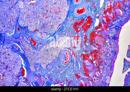 Human ovary section showing corpus luteum, stroma, epithelium and ...
