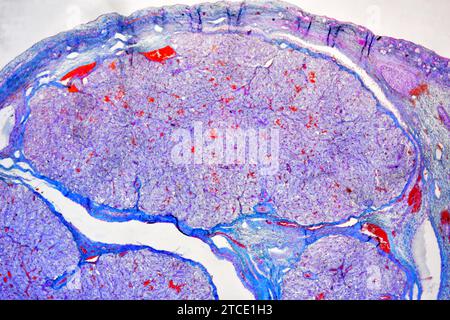 Human ovary section showing corpus luteum, stroma, epithelium and ...