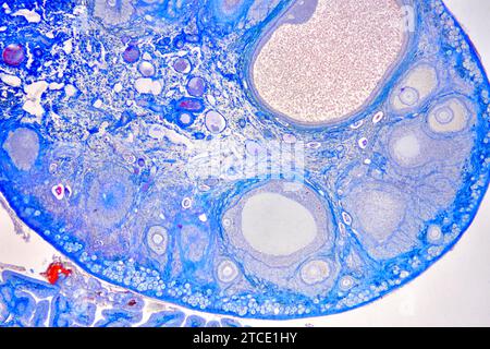 Ovary section showing stroma and ovarian follicle or Graaf follicle ...