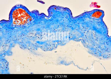 Human placenta section. Optical microscope X100 Stock Photo - Alamy