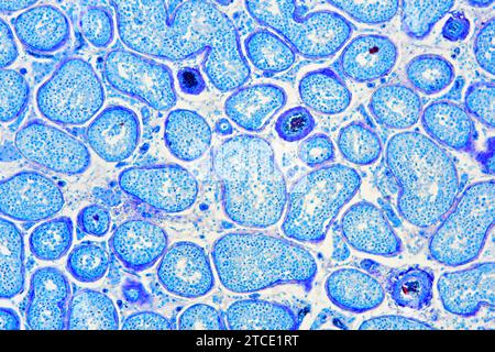 Human testicle or testis section showing seminiferous tubules, Leydig ...
