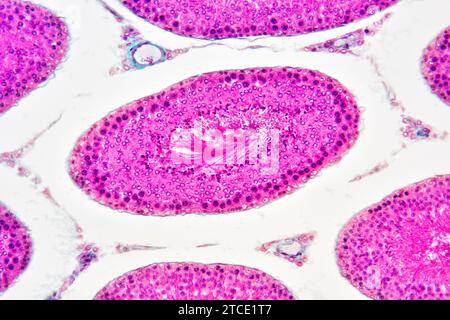 Human testicle or testis section showing seminiferous tubules, Leydig ...