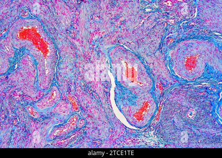 Human uterus or womb. Optical microscope X100 Stock Photo - Alamy