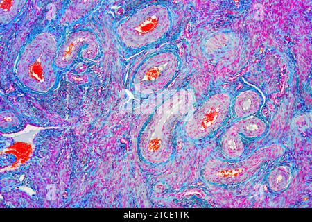 Human uterus or womb. Optical microscope X100 Stock Photo - Alamy