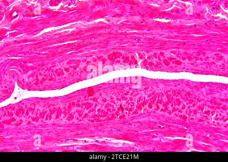 Human coronary artery with arteriosclerosis. Optical microscope X100 ...
