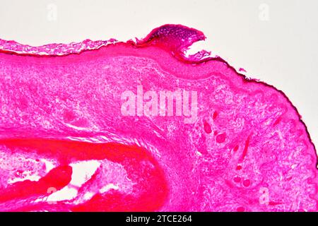 Human finger section showing epidermis (stratified squamous epithelium ...