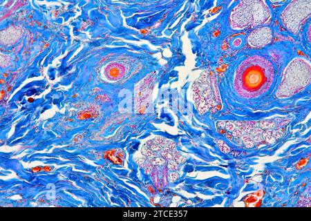 Human scalp cross section showing hair follicles, sebaceous glands and ...