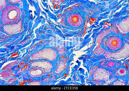 Human scalp cross section showing hair follicles, sebaceous glands and ...