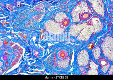 Human scalp cross section showing hair follicles, sebaceous glands and ...