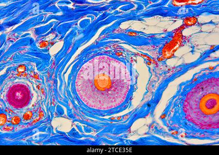 Human scalp cross section showing sebaceous glands and fibrous tissue ...
