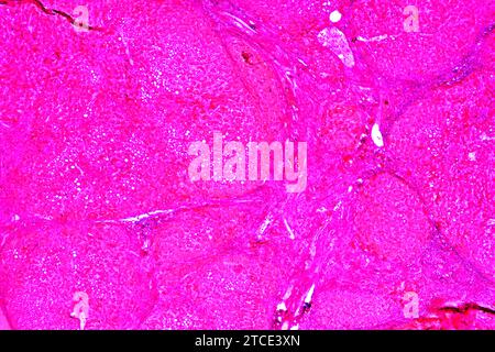Liver Histology
