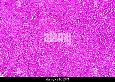Human healthy liver with normal hepatocytes. Optical microscope ...