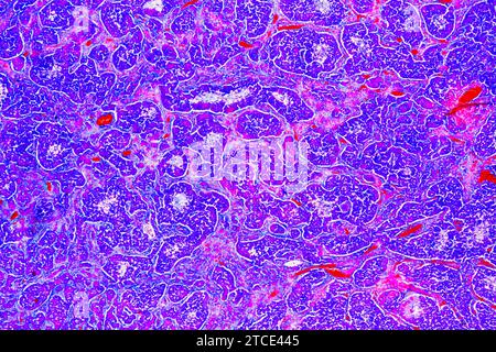 Human hypophysis or pituitary gland. Optical microscope X40 Stock Photo ...