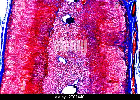 Human adrenal or suprarenal gland showing fibrous capsule, zona ...