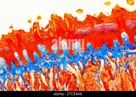 Tongue section showing lingual papillae, taste buds, gustatory or Von ...