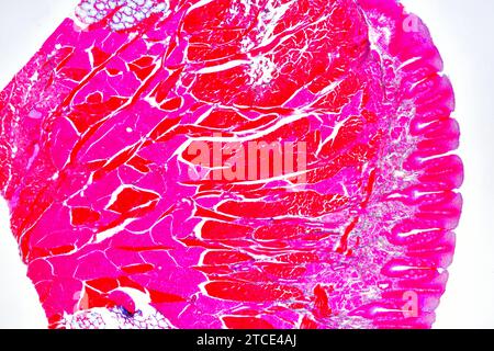 Tongue section showing lingual papillae, taste buds, striated muscles ...