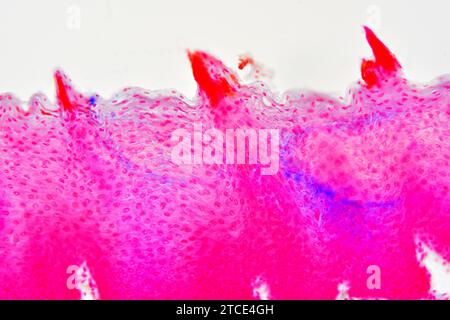 Tongue section showing lingual papillae, taste buds, striated muscles ...