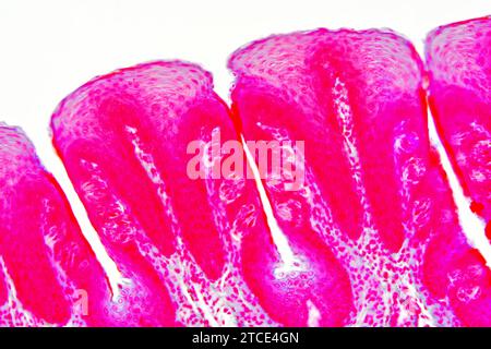 Tongue section showing taste buds, gustatory or Von Ebner glands ...