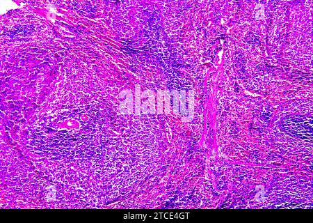 Human normal spleen. Optical microscope X200 Stock Photo - Alamy