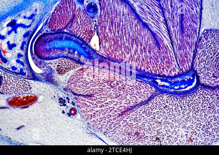 Inner ear with cochlea and tympani. Optical microscope X40 Stock Photo ...