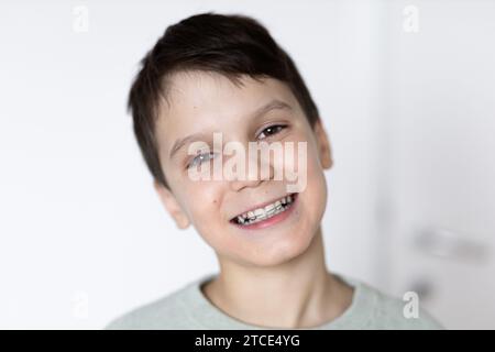 Boy smiling with tooth retainers in hand. Concept of crooked teeth ...