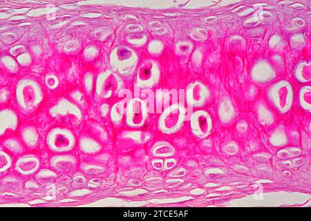 Elastic cartilaginous tissue from the ear showing chondrocytes, elastin ...