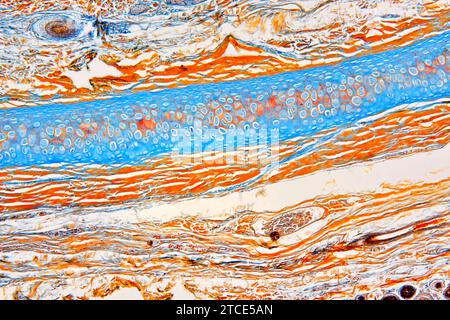 Elastic cartilaginous tissue from the ear showing chondrocytes, elastin ...
