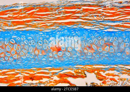 Elastic cartilaginous tissue from the ear showing chondrocytes, elastin ...