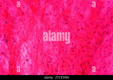 Loose connective tissue or reticular tissue showing fibroblasts ...