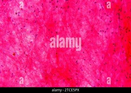 Loose connective tissue showing collagen fibers and fibroblasts ...