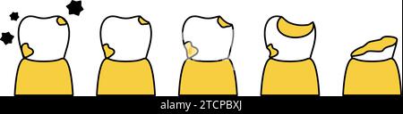 Illustration of image of cavity progression, simple line drawing ...