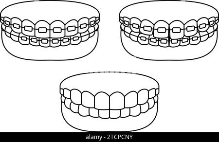 Teeth with braces illustration drawing in linear style on white ...