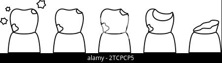 Illustration of image of cavity progression, simple line drawing ...