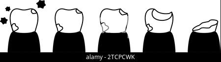 Illustration of image of cavity progression, simple line drawing ...