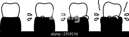 Illustration of periodontal disease progression image, simple line ...