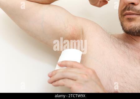 male hand, dry and with skin spots, dermatological problem, solar ...
